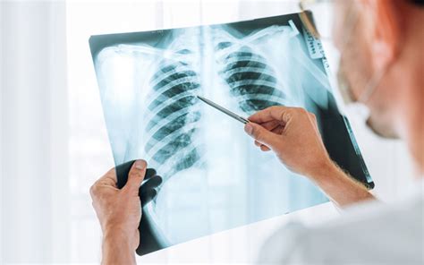 Sansure Innovating Diagnostics For All