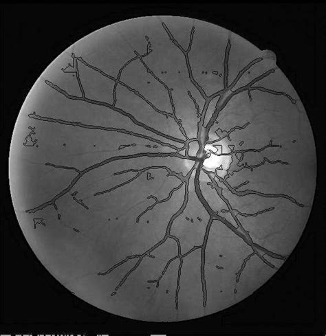 5 First Row Original Image And Manual Segmentation From The Drive