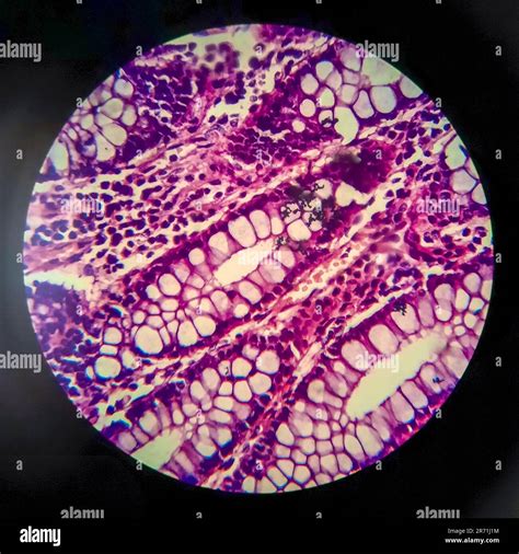 Bacterial Cell Under Light Microscope Bacteria Microscope Hi Res Stock