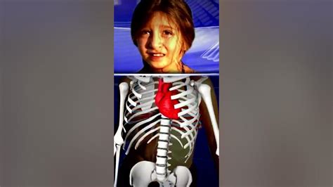 The Girl Born With Heart Outside Her Chest Youtube