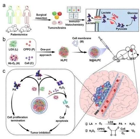 仿生剂型用于胶质母细胞瘤代谢调控和靶向协同治疗的研究取得进展 乳酸 工程 患者