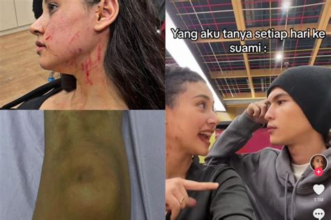 Sosok Regi Nazlah Diduga Aniaya Afifah Riyad Netizen Ternyata Pelaku Bullying Sejak Sekolah