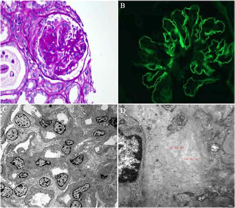 A Light Microscopy Shows The Cellular Crescent Formation And Vacuolar Download Scientific