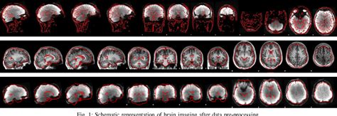 Figure 1 From Markov Guided Spatio Temporal Networks For Brain Image Classification Semantic