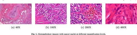 Figure 1 From Enhancing Breast Cancer Classification Via