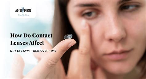 Can Contact Lenses Cause Dry Eyes Know The Reasons