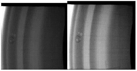一种x射线图像的对比度增强方法与流程