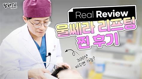 마취크림으로 울쎄라 통증 괜찮을까 울쎄라 셀프시술 찐 후기 Start Youtube