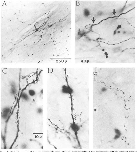 Figure 1 From Morphology And Electrophysiological Properties Of