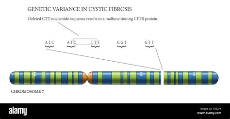 Type Of Mutation That Causes Cystic Fibrosis At Andres Lowe Blog