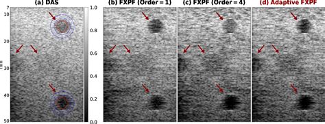 Figure 1 From Frequency Space Prediction Filtering For Phase Aberration Correction In Plane Wave