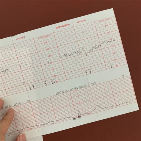 쌍둥이 임신 27주 1일 ~ 28주 2일차 임신후기 진입 임신8개월 쉬즈메디산부인과 태동검사 자궁경부길이체크 네이버 블로그