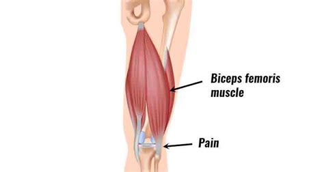 Hamstring Tendonitis Symptoms Causes Treatment And Rehab