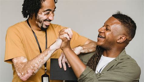 Vitiligo Types Causes Symptoms Treatment Of Leukoderma Or White