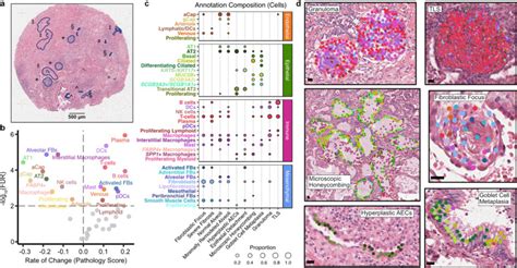 Image Based Spatial Transcriptomics Identifies Molecular Niche Dysregulation Associated With