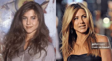 Jennifer Aniston Example Of Plastic Surgery Success Dr Vitolo