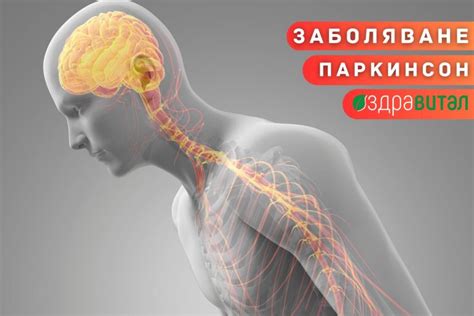 Паркинсон - Здравитал