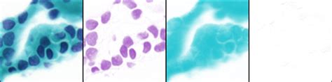 Colour Deconvolution 2 Novel Context Based Segmentation Algorithms