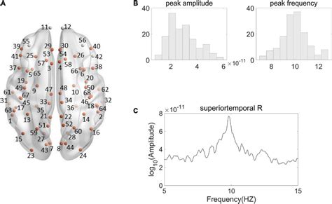 Illustration Of Alpha Peak Activity In The Frequency Spectrum A Download Scientific Diagram