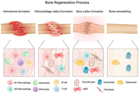 The Figure Of Bone Fracture Healing Process The Several Phases Of Download Scientific