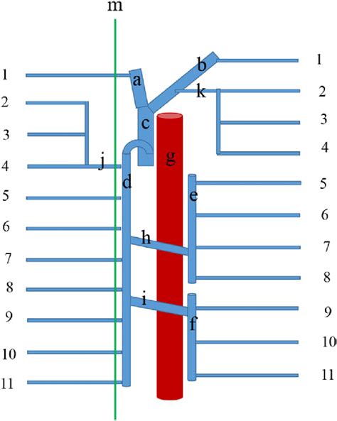 Schematic Illustration Of The Variations A Right Brachiocephalic Vein Download Scientific