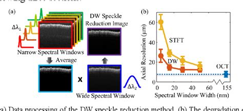 Figure 1 From Real Time Speckle Reduction In Optical Coherence Tomography Using The Dual Window