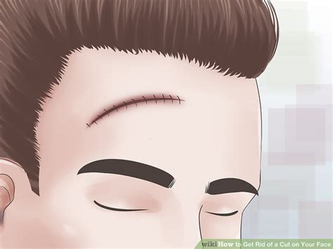 How To Get Rid Of A Cut On Your Face With Pictures WikiHow