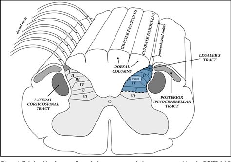 Figure 1 From Dorsal Root Entry Zone Lesioning For Brachial Plexus