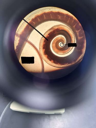 Lab Nematode Slides Flashcards Quizlet