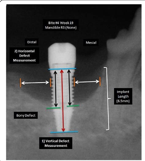 Vertical Depth Black Arrows And Horizontal Width White Arrows