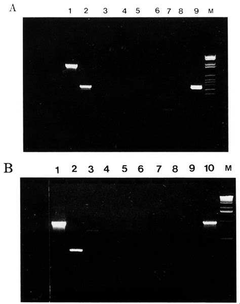 Fmdv Detection In Tongue Epithelial Sample From Suspect Cattle Rna Was