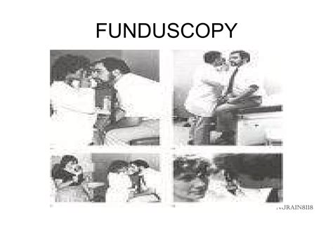 Funduscopy Ppt