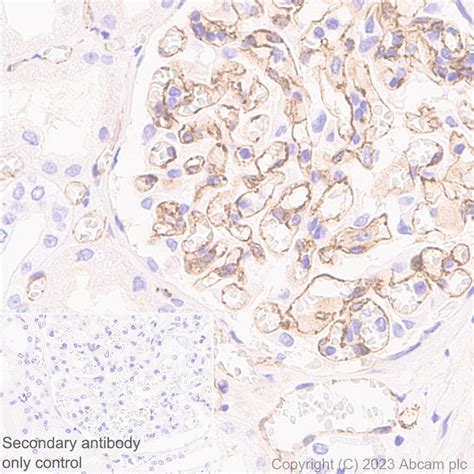 Anti Ve Cadherin 抗体 [epr27436 55] Ab313632 アブカム
