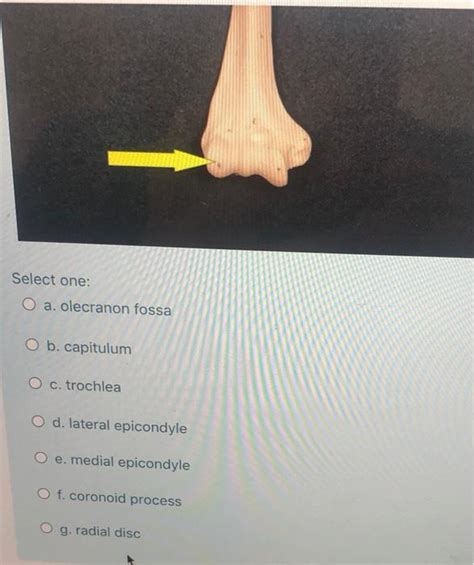 Solved Hed Select One O A Olecranon Fossa O B Capitulum O
