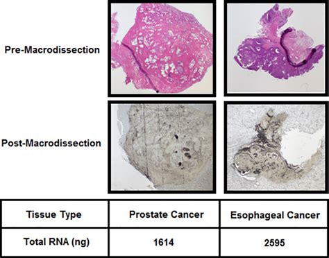 Rna Extraction From Ffpe Tumor Tissues Integrated Laboratory Systems