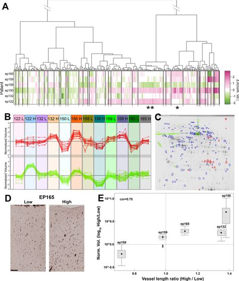 Hierarchical Clustering By Protein Spot Expression Patterns A Spots Download Scientific