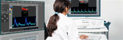 Color Doppler Imaging DWL