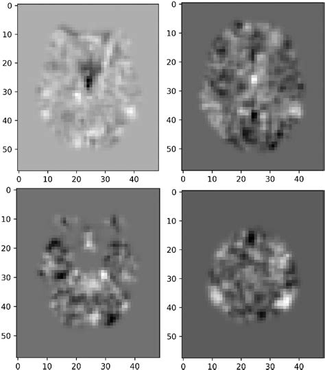Figure 1 From Attention Deﬁcit Hyperactivity Disorder Classiﬁcation Based On Deep Learning