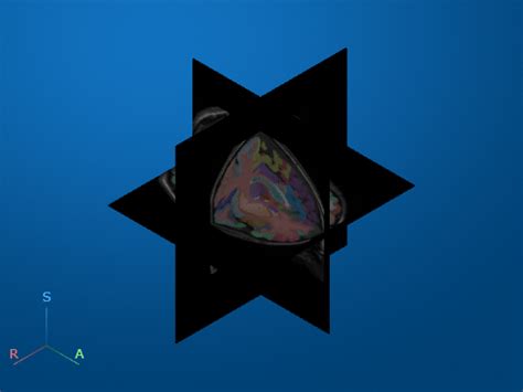 Segmentation Matlab And Simulink