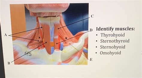 Solved Identify Muscles Thyrohyoid Sternothyroid