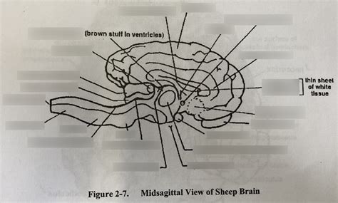 Midsagittal View Of Sheep Brain Diagram Quizlet