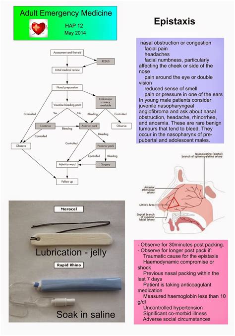 Adult Emergency Medicine Epistaxis