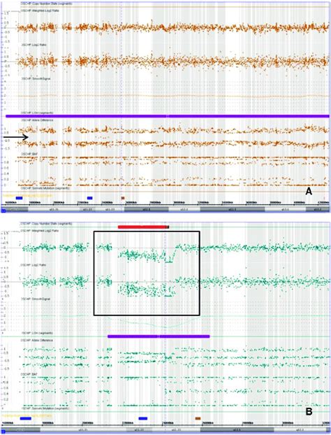 Representative Chromosomal Microarray Results A Case 2 Demonstrates Download Scientific