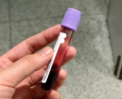 懷孕多久做b超檢查比較好？這份孕早期檢查攻略，孕媽們查收學習 每日頭條