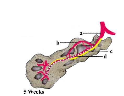 Radiological And Embryological Relevance Of Persistent Sciatic Arteries