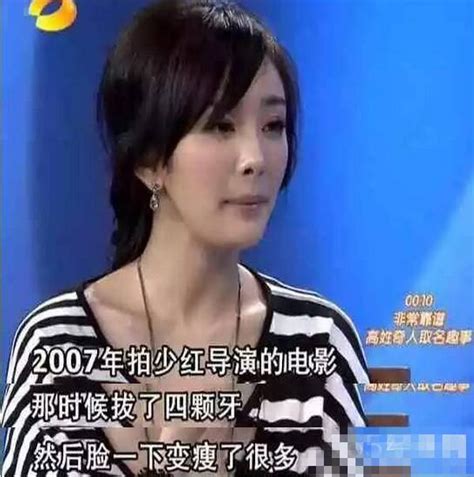 10年前楊冪只配給劉亦菲撐傘？有沒有整容看完便知！ 每日頭條