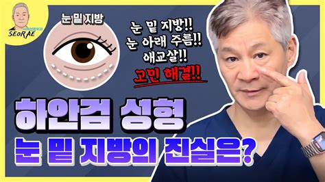 하안검 성형 눈 밑 지방의 진실은 Youtube