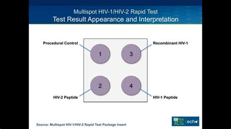 Hiv Testing Algorithm Cdc At Mary Settle Blog