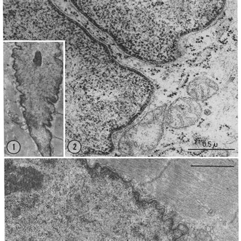 Typical Rat Skeletal Muscle Nucleus Showing The Greatly Invaginated Download Scientific Diagram