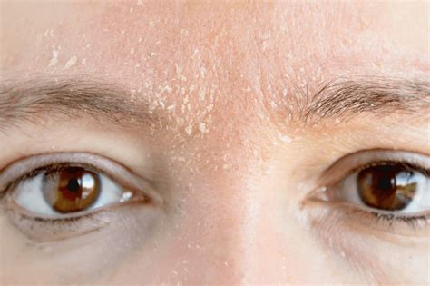 Say Goodbye To Dry Skin On Your Face Tips And Tricks To Treat It Skin Care Geeks